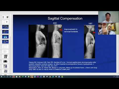 Institute for Spine and Scoliosis