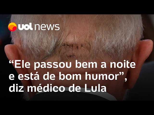 'Ele passou bem a noite e está de bom humor', diz médico de Lula