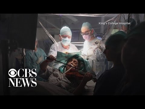 Woman plays violin to guide doctors during brain surgery