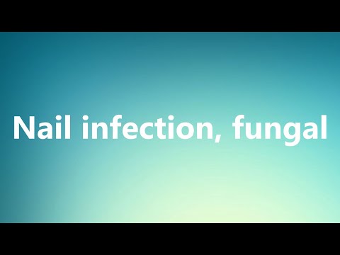 Nail infection, fungal - Medical Definition and Pronunciation