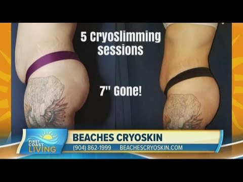 Look and feel your best with the help of Beaches Cryoskin (FCL August 1st)