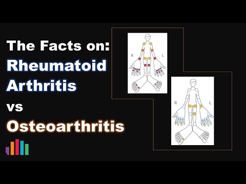 New Treatments For Knee Arthritis. Part 3 of 3 – Jeremy Triplett MD