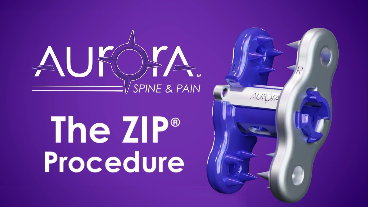 Aurora ZIP Procedure | All Star Pain Management & Regenerative Medicine