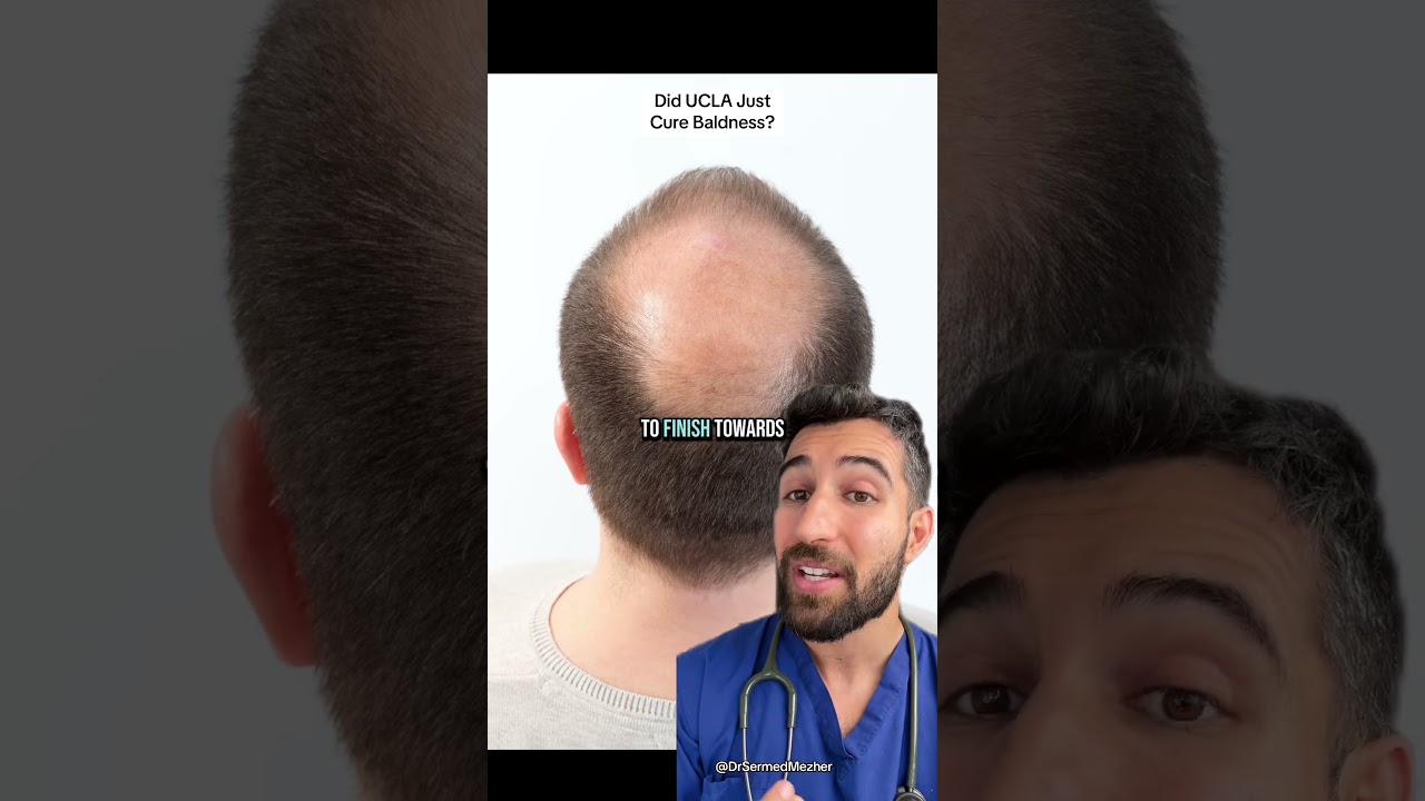 Scientists Might Have Just Cured Male Pattern Baldness #how