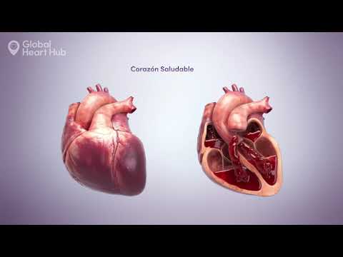 Argentina (Spanish) - Heart Failure Awareness Week - Campaign Animation