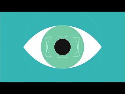 Visian ICL Explained