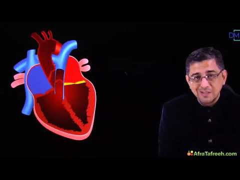 Cardiology Mitral Valve Prolapse with animation #medicaleducation