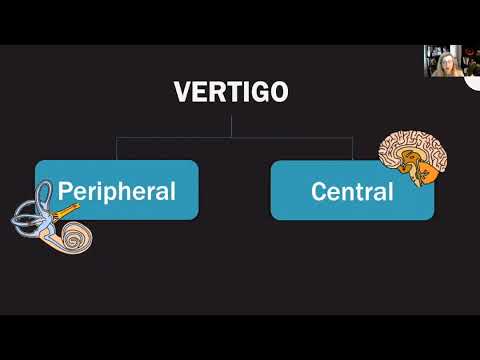 Myth Busted again! Central vs Peripheral Tables of Vertigo