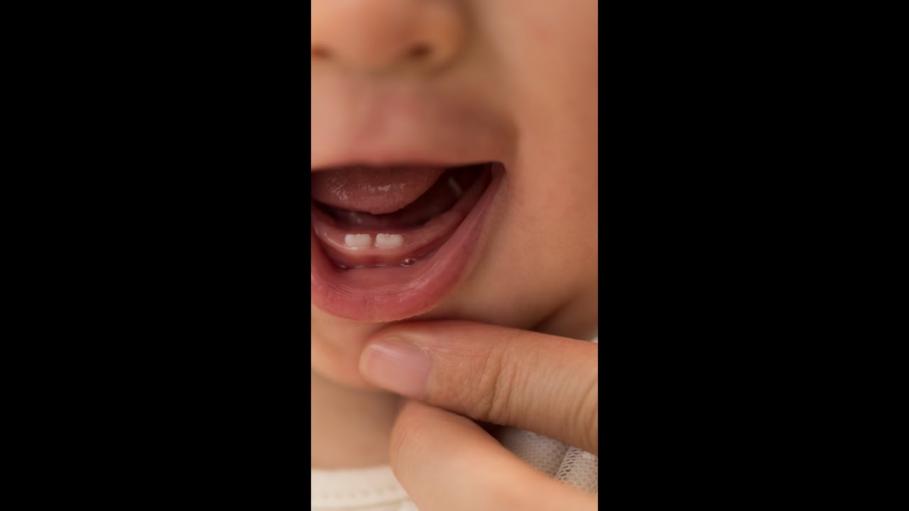 Signs of teething in babies