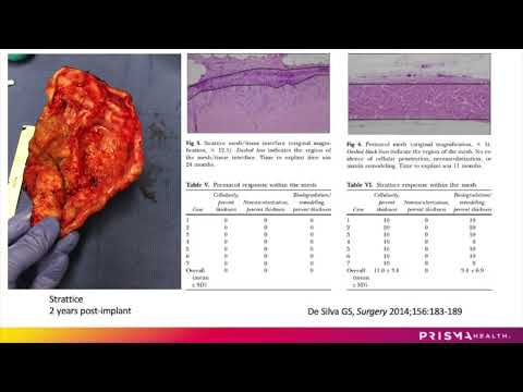 Should I Use Synthetic Mesh in Contaminated Fields?