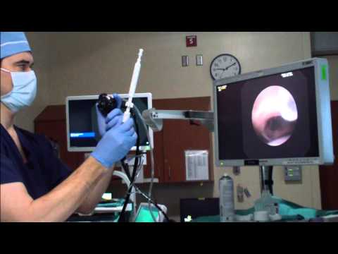 Endobronchial Ultrasound (EBUS) Technique & Tips