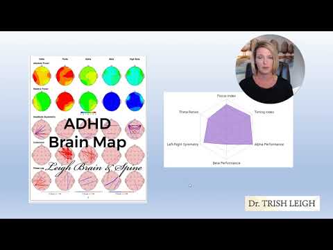 What Does the ADHD Brain Map Look Like?