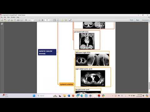 Congenital lung, airway and vascular anomaly revesion