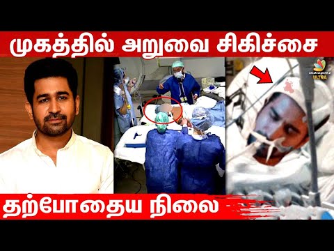முகத்தில் படுகாயம்???? Surgery-க்கு பின் Vijay Antony சொன்ன விஷியம் | Pitchaikaram 2