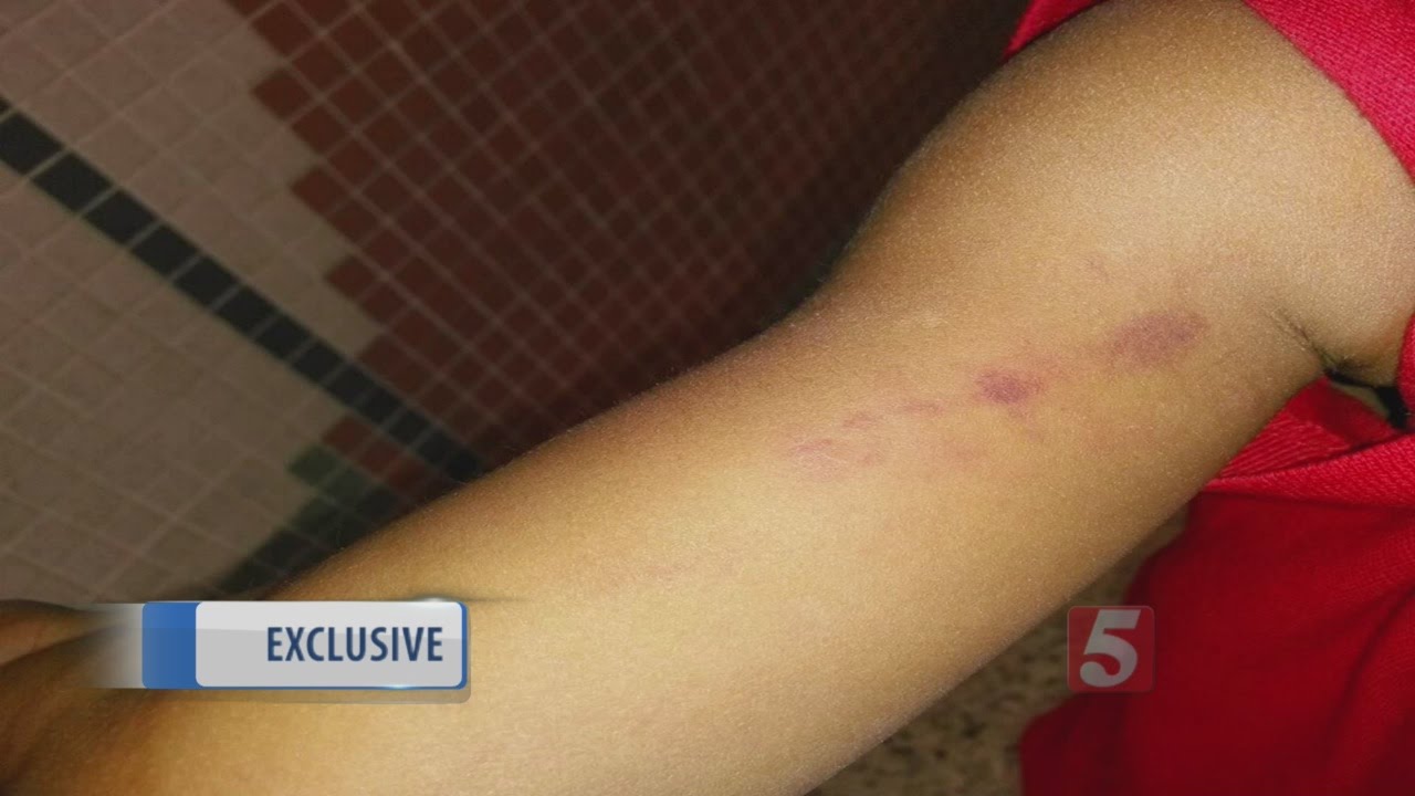 Maury Co. Student Claims Teacher Hurt Her