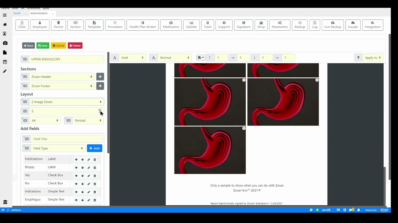 How to edit a a report template   ZSCAN EVO