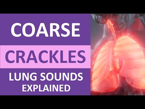 Coarse Crackles Nursing Review