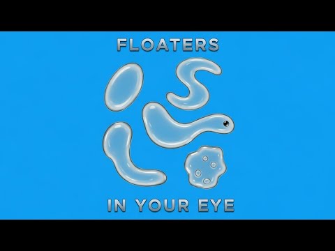 What are those floaty things in your eye? - Michael Mauser