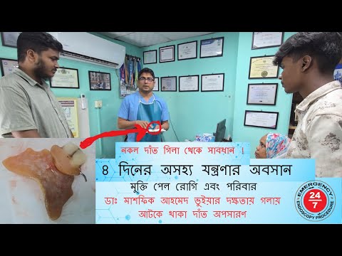 স্পেশালাইজ ইন্টারভেনশন এন্ডোস্কপি ইউনিট Specialized Intervention ...