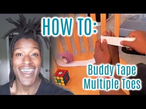 BROKEN TOES UPDATE // How I Buddy Tape My Toes