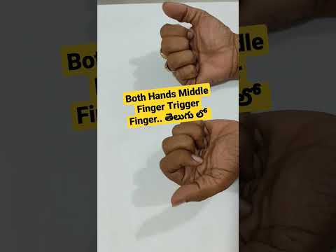 Both Hands Middle Finger Trigger Finger.. తెలుగు లో ..Dr Sai Chandra #kneereplacementsurgeon
