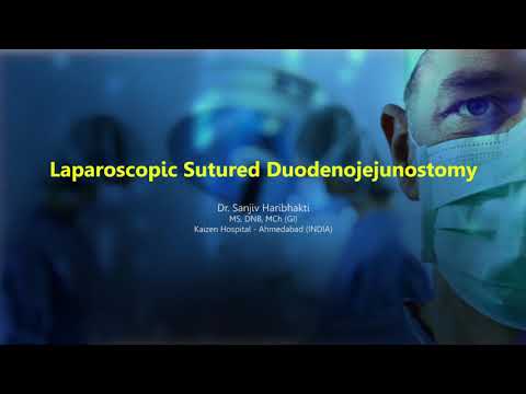 Laparoscopic Sutured Duodenojejunostomy - Dr. Sanjiv Haribhakti