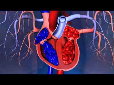 What are the different types of heart surgeries?