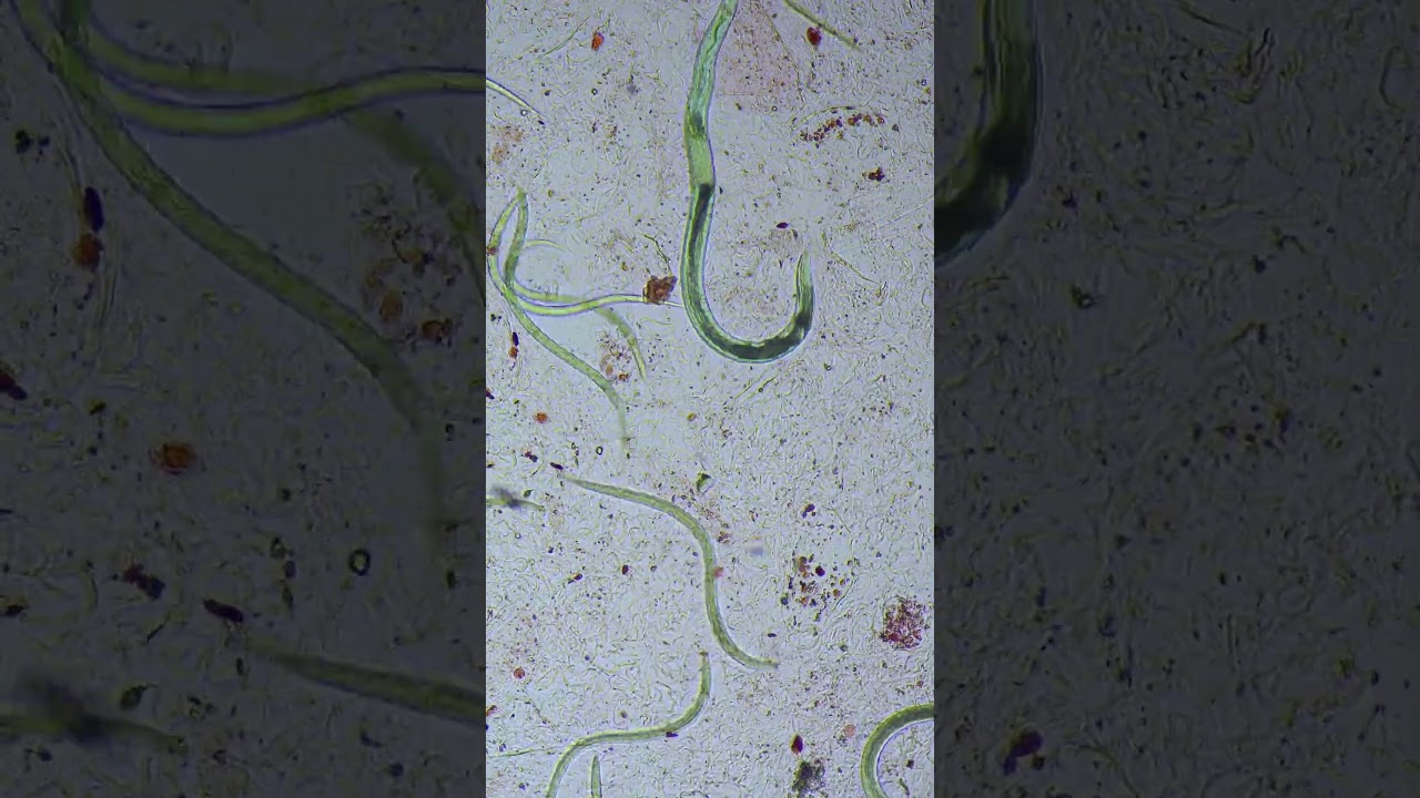 Ketchup and human parasites  | TULO - Microscope