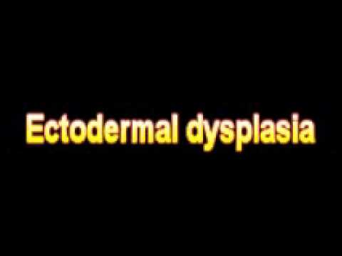 What Is The Definition Of Ectodermal dysplasia - Medical Dictionary Free Online