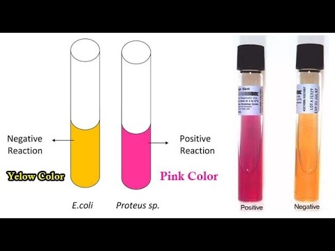 Urease Test : A Biochemical test for Differentiation of Bacteria like Enterobacteriaceae and Fungus