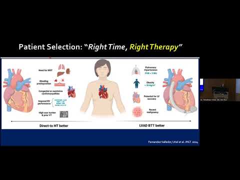 Mechanical Circulatory Support as a Bridge to Heart Transplant in the Current Era