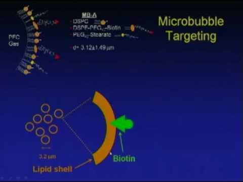 Principles of Ultrasound Molecular Imaging