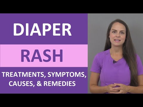 Diaper Rash: Creams, Treatments, Symptoms, Ointment, and Causes