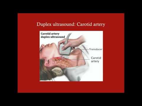 Carotid Artery Disease - CRASH! Medical Review Series