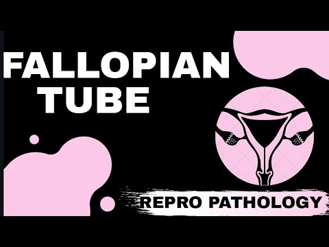 SALPINGITIS ( Female reproductive system pathology) | Med Bees