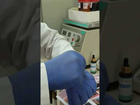 Propolis A cure of Leishmaniasis#propolis#antiviral#corona virus#imuno booster