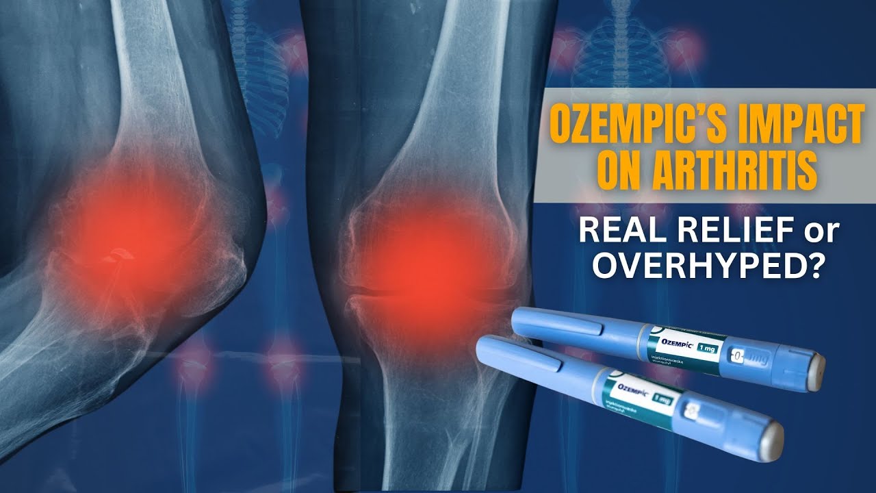 Can You Use Ozempic for Arthritis?