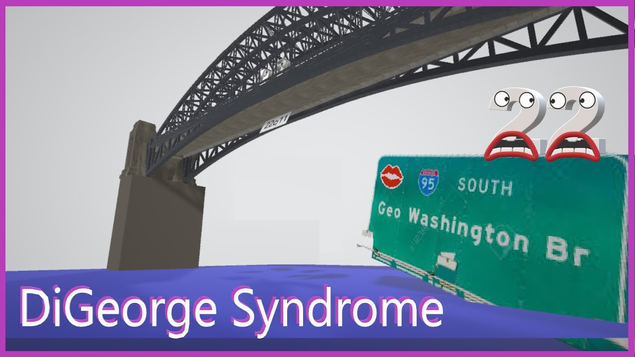 DiGeorge Syndrome (Mnemonic)