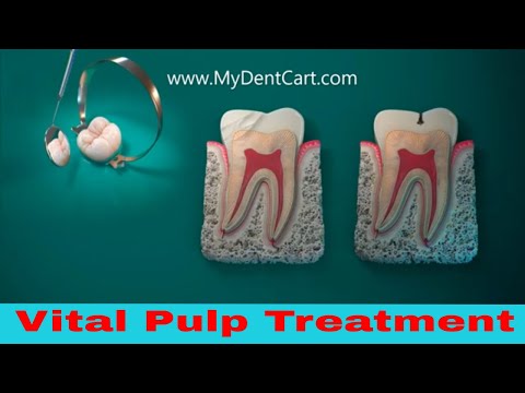 How vital pulp treatment done?