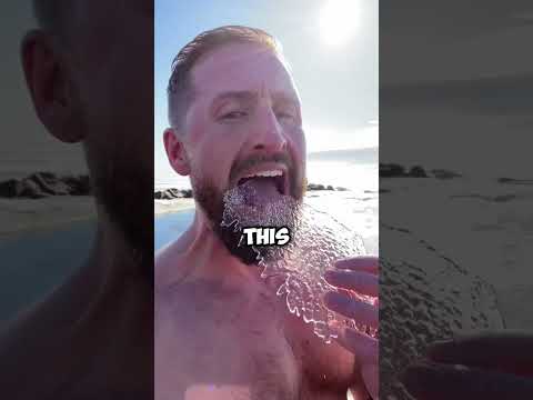 🚫 Stop Eating ICE CUBES!!! 🧊 #shorts