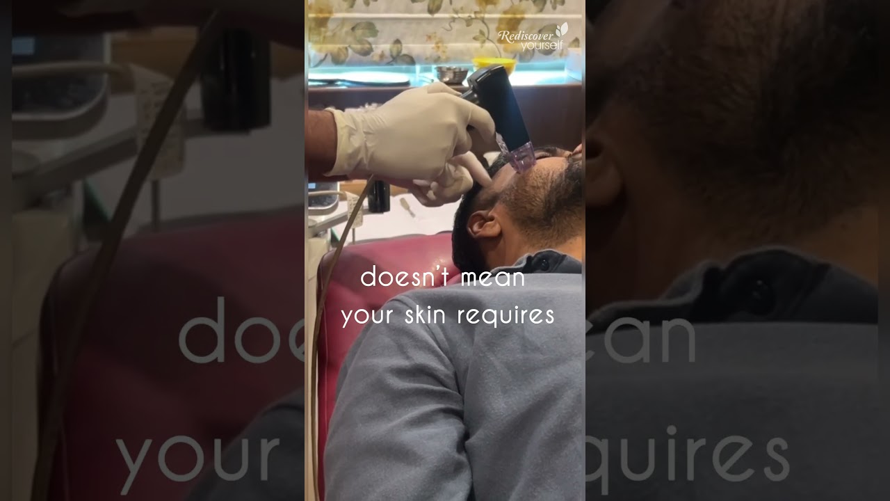 Morpheus8 for Men | Skin Tightening, Acne Scars & Anti-Aging Without Surgery