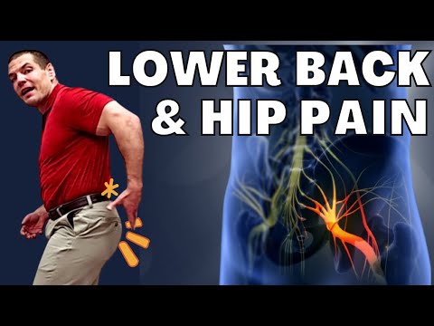 Radiating LOWER BACK PAIN To Hip - 5 Causes + Tips To Help