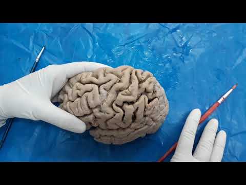 Cerebral hemisphere (Sulci and Gyri)- Neuroanatomy