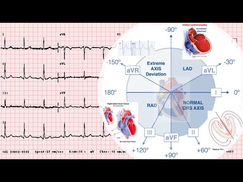 Master Cardiac Physiology | ECG Interpretation: Cardiac Axis in 3 Minutes with Clinical Cases