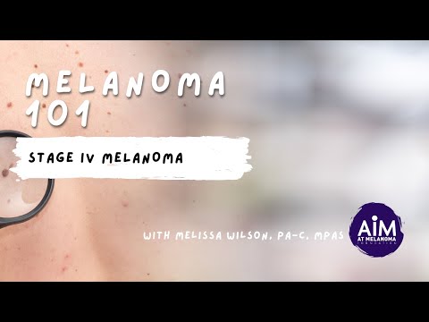 What is Stage IV Melanoma?