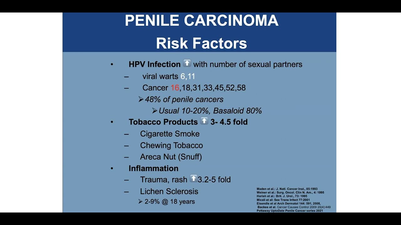 Penile Cancer Update 2022