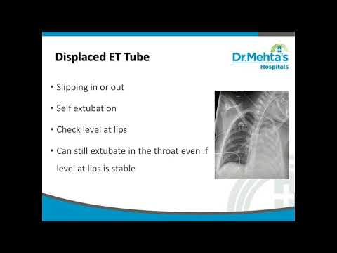 DOPE - What to do when there is sudden deterioration in ventilated baby?