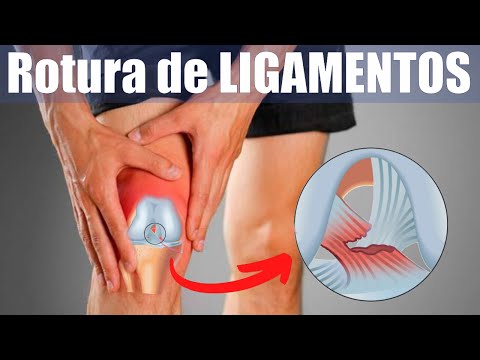 KNEE LIGAMENT RUPTURE 🥵 ARTHROSCOPIC SURGERY ⭐ Dr. WALTER ALVARADO Traumatology 24 hours a day