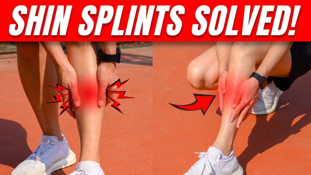 How to Fix Shin Splints in 30 Seconds! (Spoon)