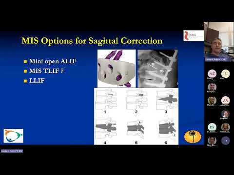 Evolution of MIS Capacity: Robert K. Eastlack, MD